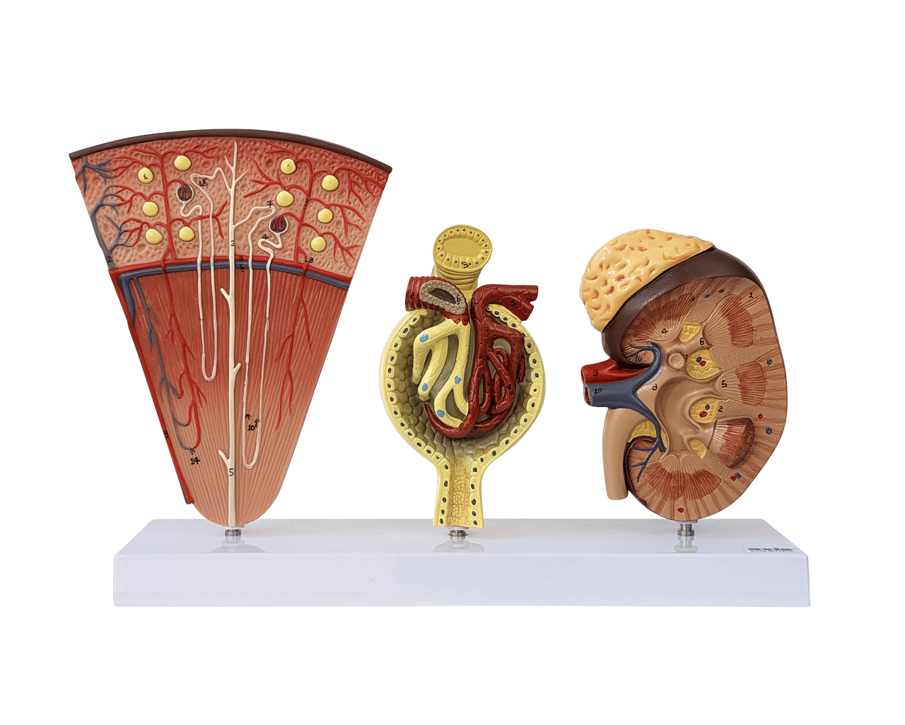 Axis Scientific Kidney Model with Nephrons and Glomerulus | Anatomy ...