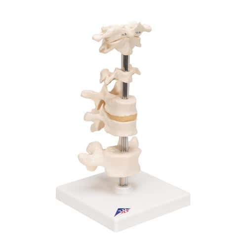 GPI Anatomicals Four Stage Vertebrae Set Anatomy Model | Anatomy Warehouse