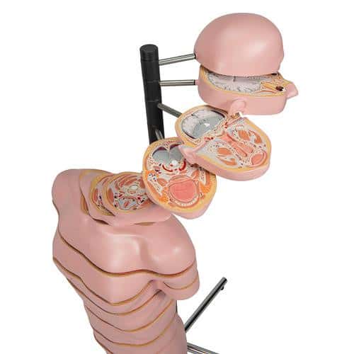 3B Scientific MRI Human Torso Anatomy Model (15 Slices) | Anatomy Warehouse