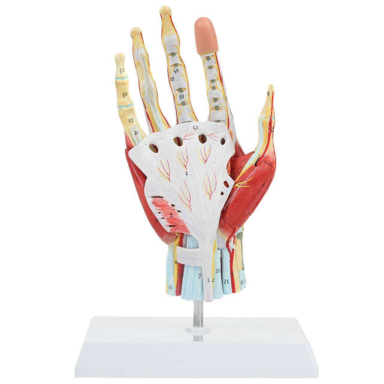 GPI Anatomicals Osteoarthritis Hand Anatomy Model | Anatomy Warehouse