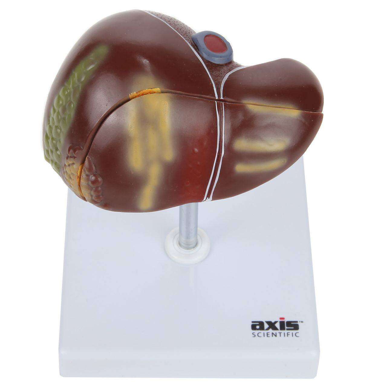 Anatomy Warehouse - Body Parts of the Chest & Abdomen - Liver Models
