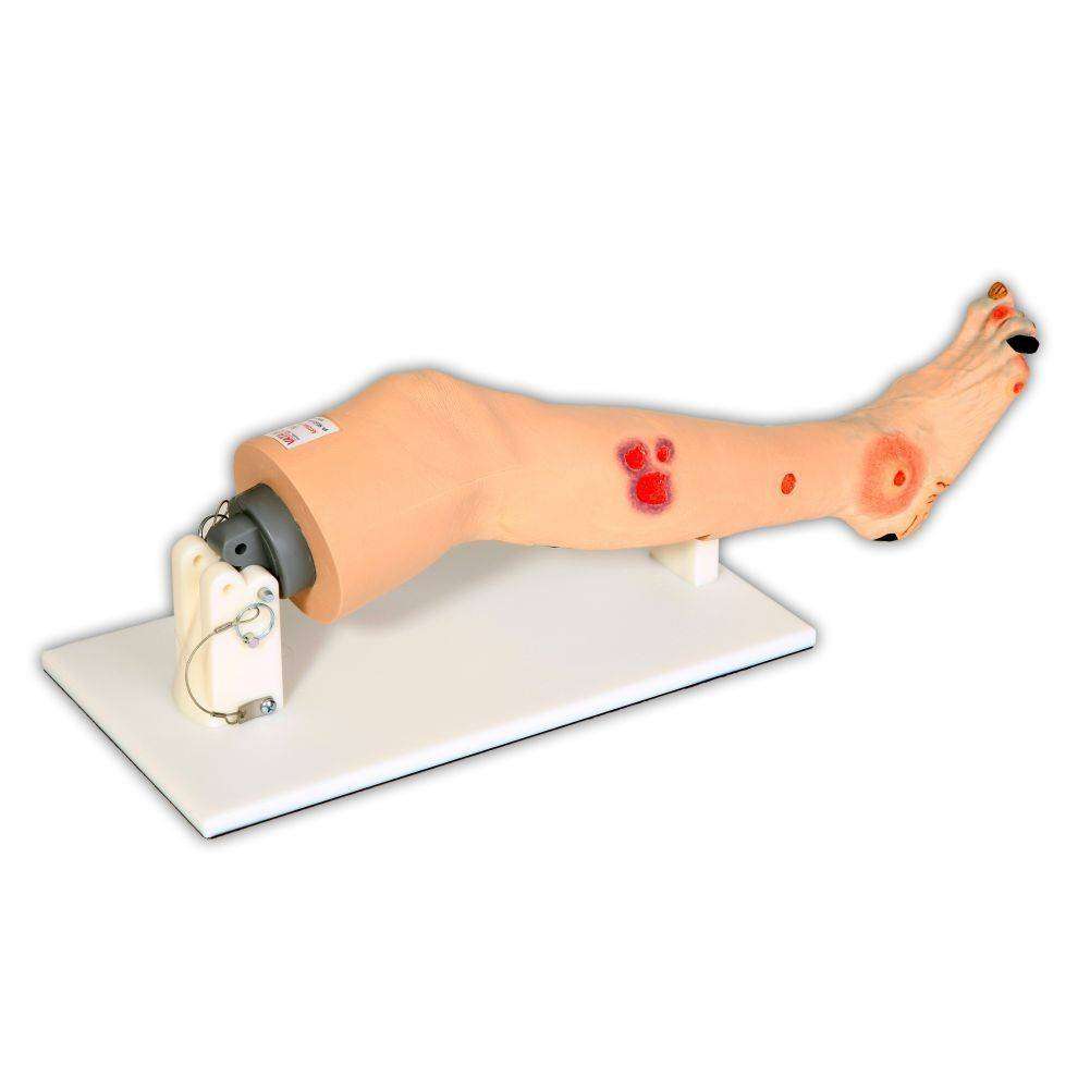 VATA Annie Arterial Insufficiency Leg Model | Anatomy Warehouse