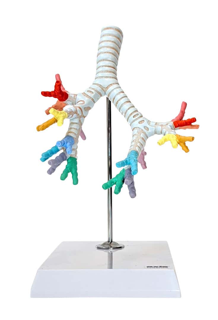 GPI Anatomicals Diseased Lung Anatomy Model | Anatomy Warehouse