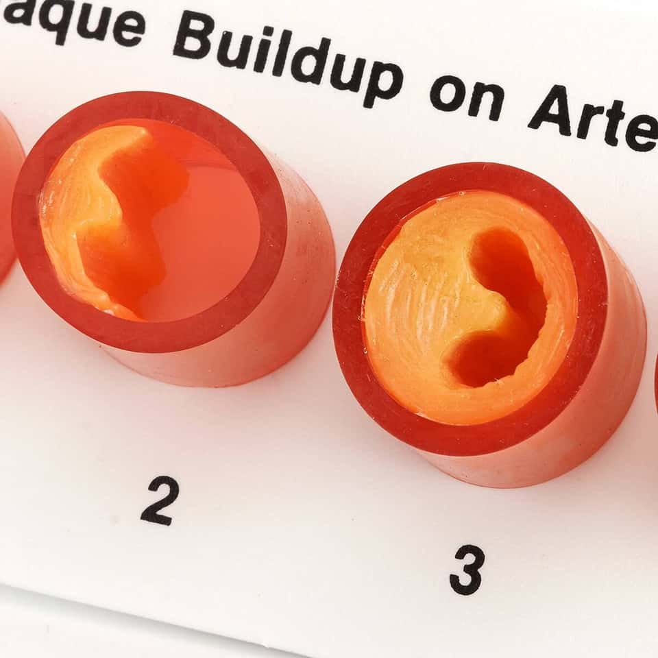 Vein and Artery Models