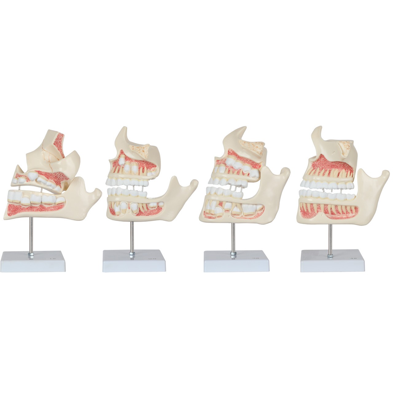 Denoyer-Geppert Dental Morphology Series Anatomy Model | Anatomy Warehouse