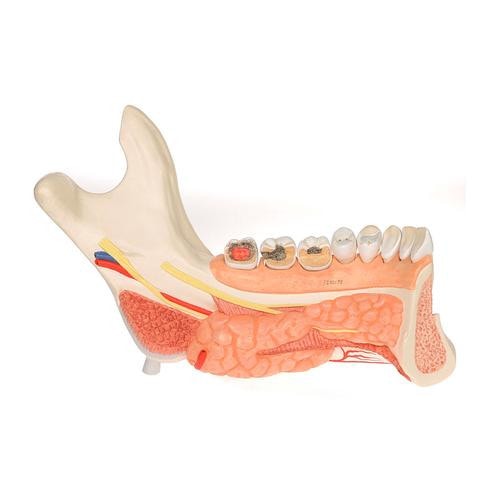 3B Scientific Advanced Half Lower Jaw Anatomy Model With 8 Dissected ...