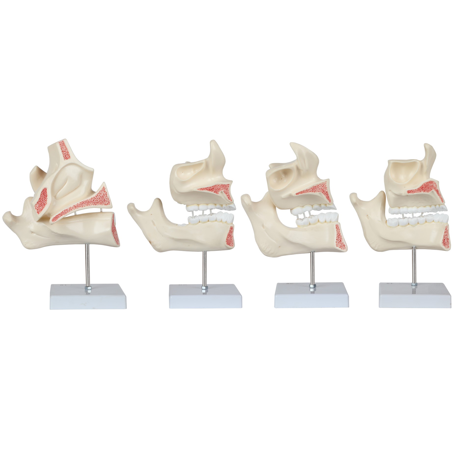 Denoyer-Geppert Dental Morphology Series Anatomy Model | Anatomy Warehouse