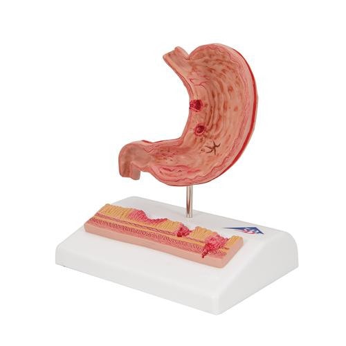 Anatomy Warehouse - Body Parts - Stomach Anatomy Models