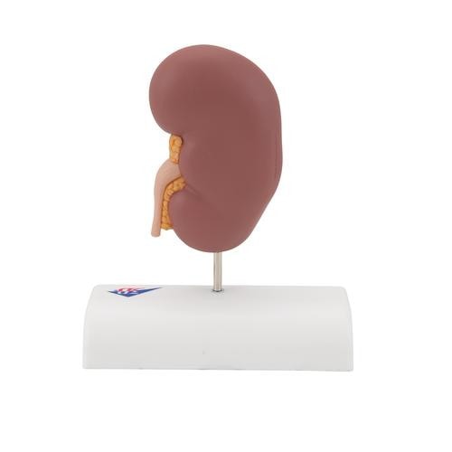 3B Scientific Kidney Stone Anatomy Model | Anatomy Warehouse