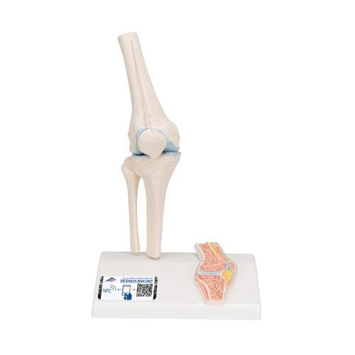 3B Scientific Mini Knee Joint Anatomy Model | Anatomy Warehouse
