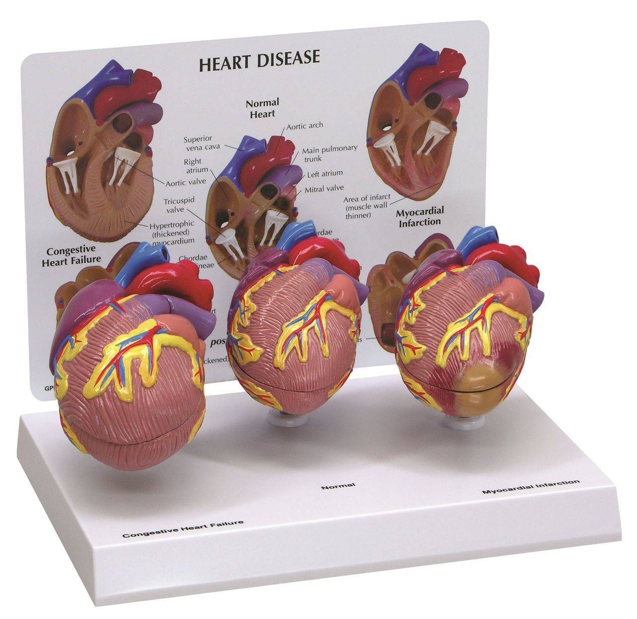 Shop Heart and Vascular System Anatomy Models from Anatomy Warehouse