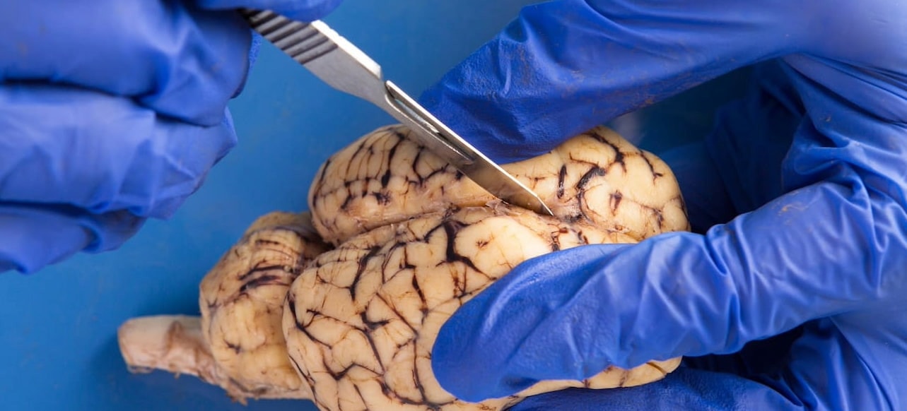 The Right Tools for a Dissection Kit - Anatomy Warehouse