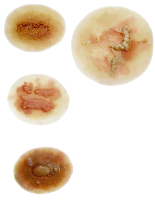 The Anatomy Lab - Insect & Snake Bites Moulage Kit