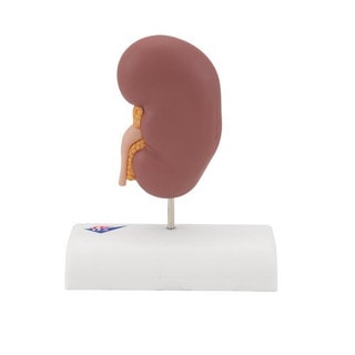 3B Scientific Kidney Stone Anatomy Model | Anatomy Warehouse