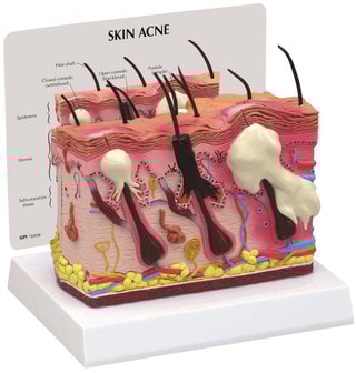 Integumentary System Anatomical Models for Education & Medical Study ...