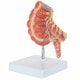 GPI Anatomicals Colon Anatomy Model With Pathologies | Anatomy Warehouse