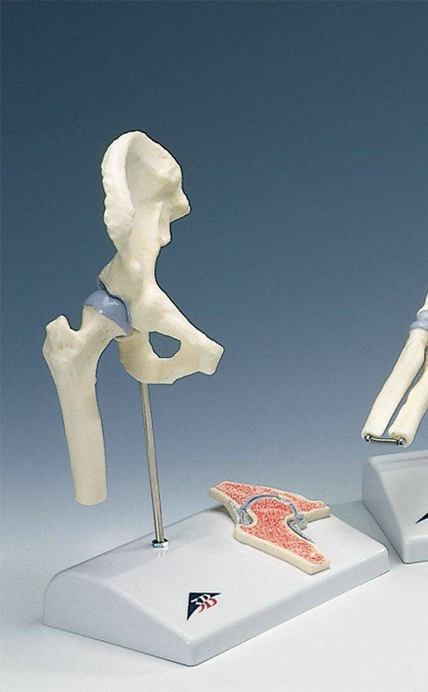 3B Scientific Mini Joint with Cross Section Anatomy Model Set | Anatomy ...