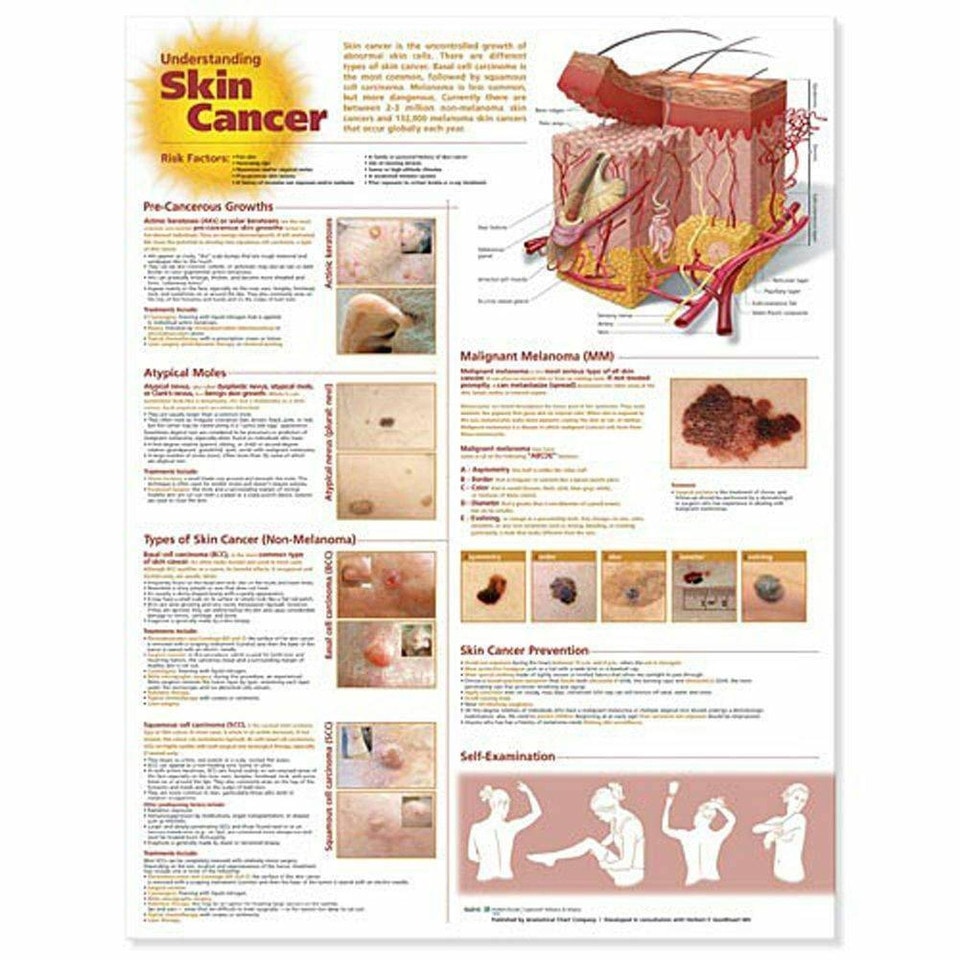 Human Integumentary System Anatomy Charts for Education | Anatomy Warehouse