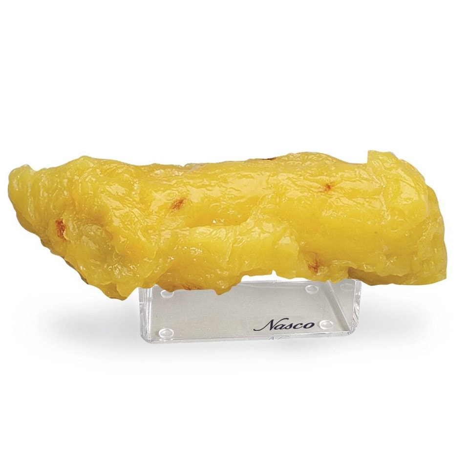 Nasco Healthcare 1-lb. Body Fat Replica on Base | Anatomy Warehouse