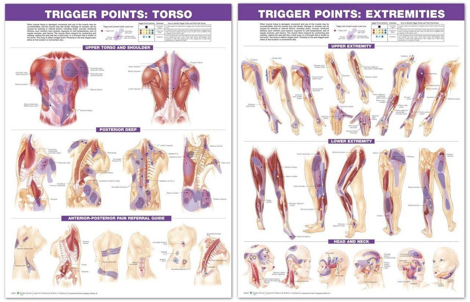 Anatomical Chart Company Trigger Point Chart Set Torso and Extremities ...